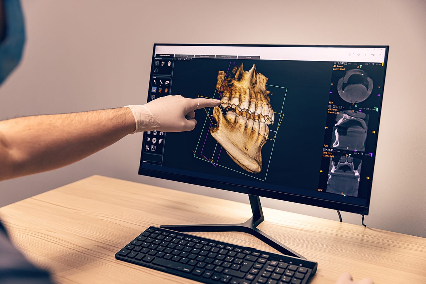3D Dental Imaging in Citrus Heights - Citrus Heights Dental